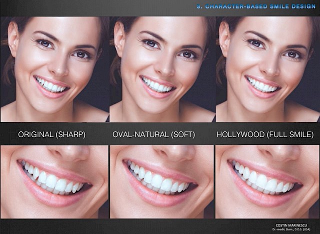 Smile Anti-Aging | Smile Munich